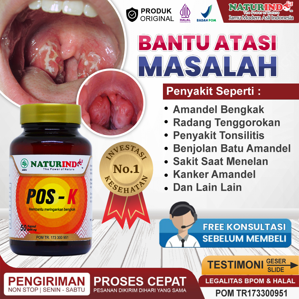 Jual Obat Amandel Paling Ampuh Tonsilits Batu Amandel Tanpa Operasi ...