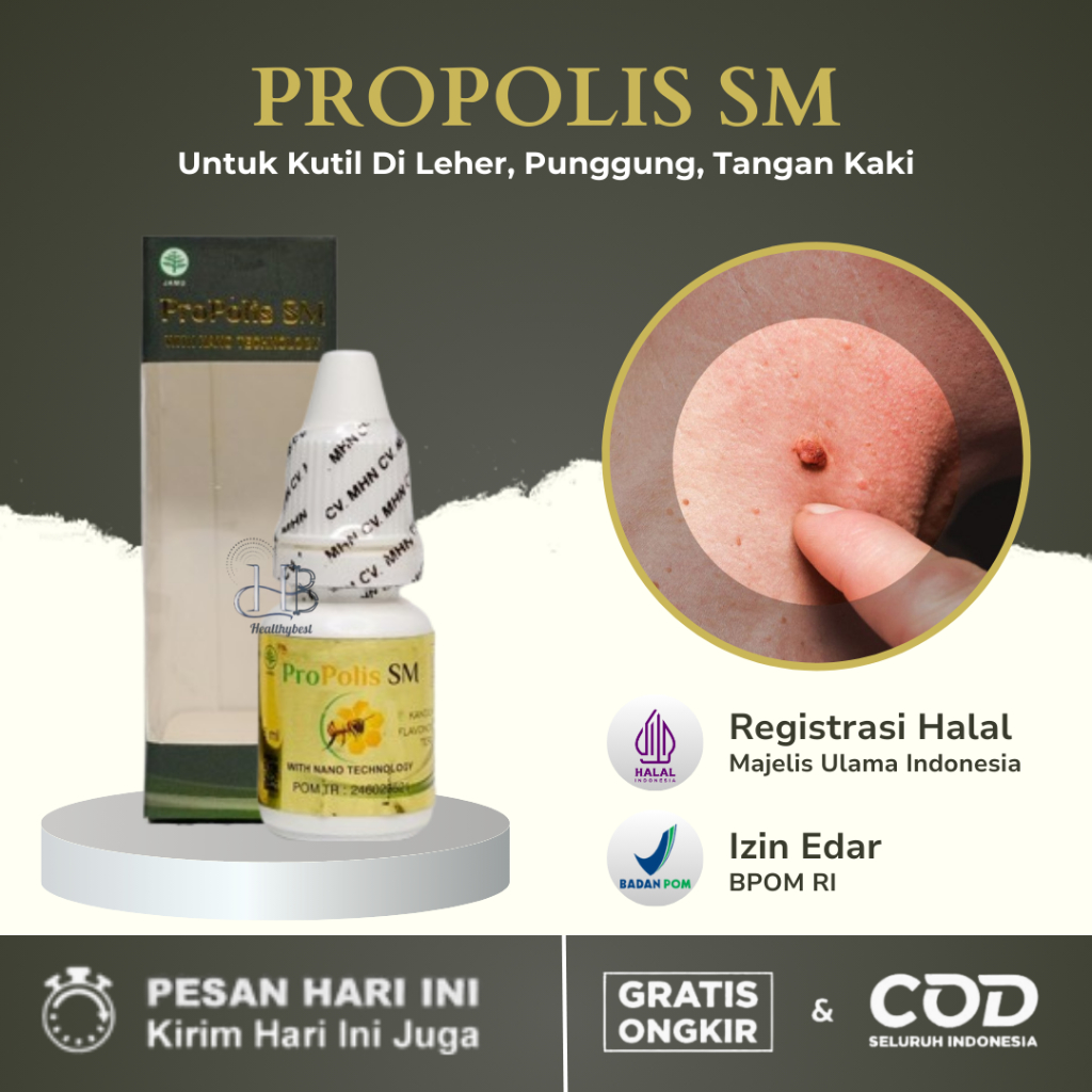 Jual Obat Herbal Perontok Kutil, Di Leher, Punggung, Dada, Wajah ...