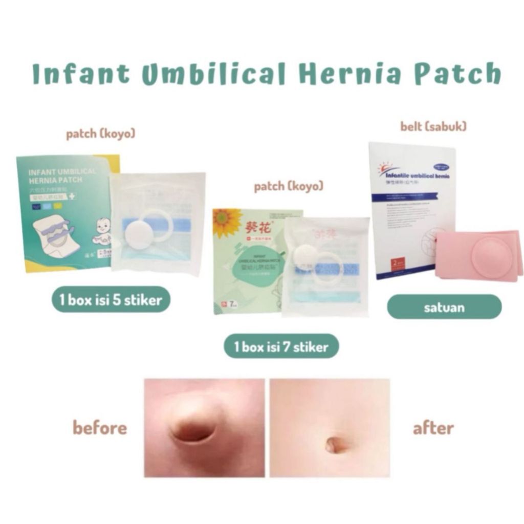 Jual STIKER Hernia Anak / Stiker Hernia Infant Umbilical Hernia Patch ...