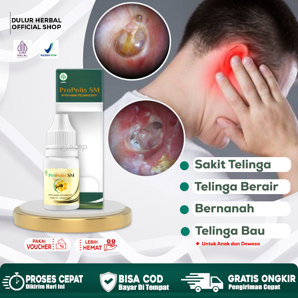 Jual Obat Tetes Telinga Propolis SM Mengatasi Gangguan Telinga Berair ...