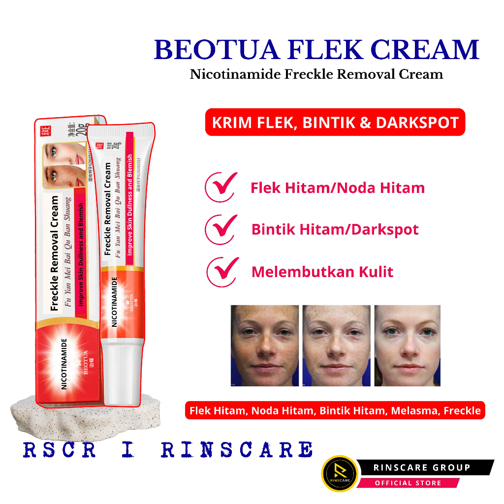 Jual [ DARK SPOT CREAM ] Beotua Nicotinamide Freckle Cream Blemish 20gr ...