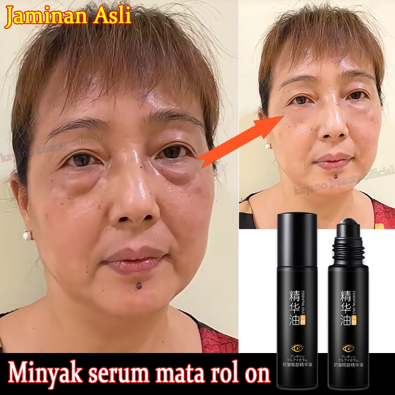Jual Minyak Esensi Mata Anti Kerut Penghilang Lingkaran Hitam Mata ...