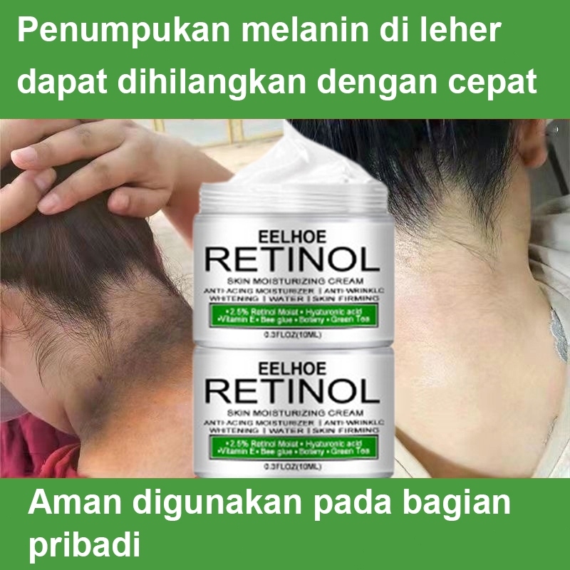 Jual Cream Pemutih Ketiak pemutih selangkangan dan miss v pembersih ...