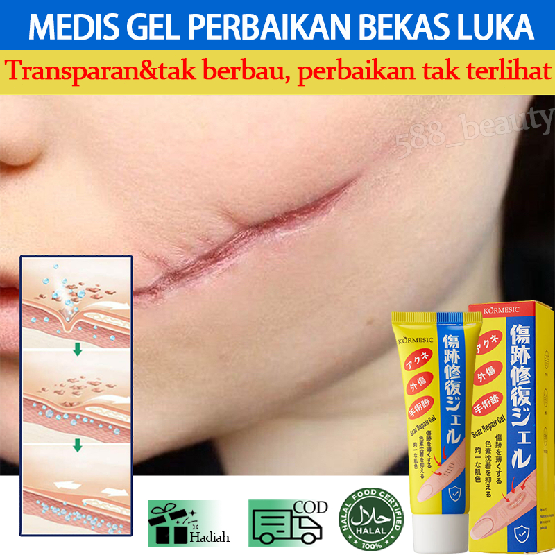 Jual Penghilang bekas luka40gScar Repair Gel |Surgical scar ...