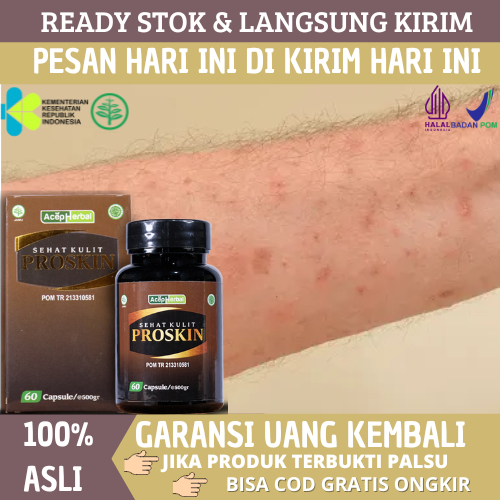 Jual Obat Gatal, Obat Budug, Obat Borok, Oba Gatal Bernanah, Obat Budug ...