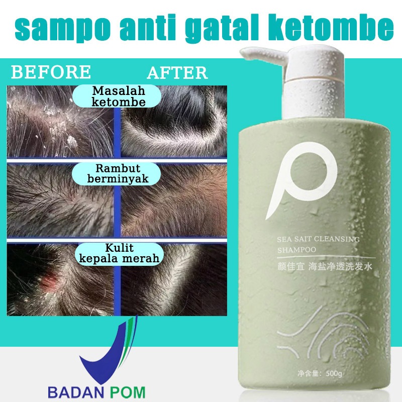 Jual 【READY】Shampo buat ketombe penghilang anti gatal pengobatan tungau amino memperbaiki rambut ...