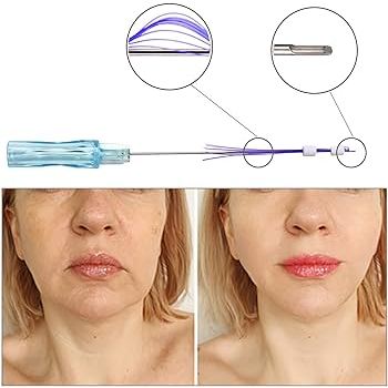 Jual Minerva Multi cog PDO/PCL 23Gx38mm(20PCS)Benang Batang Cog PDO ...