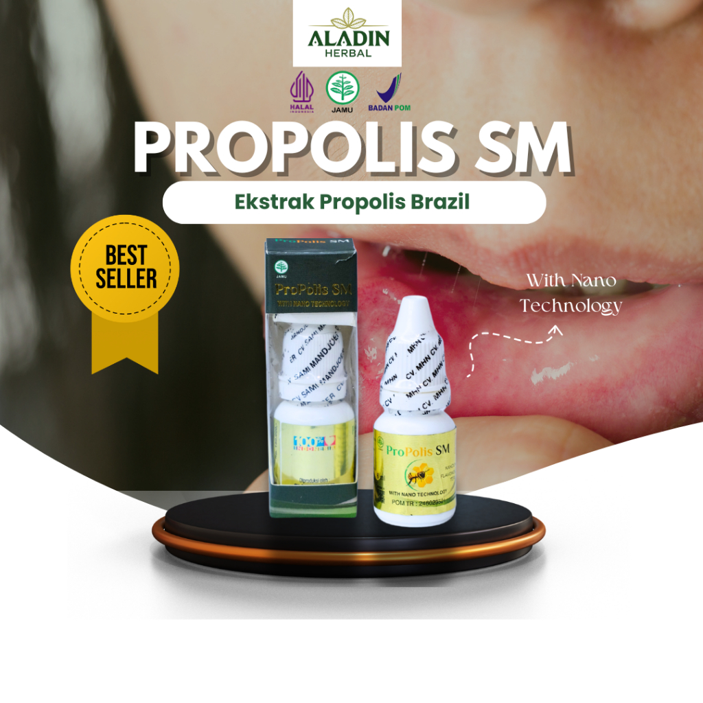 Jual Aladeena Herba - Propolis Sm untuk Mukokel Bibir Original ...