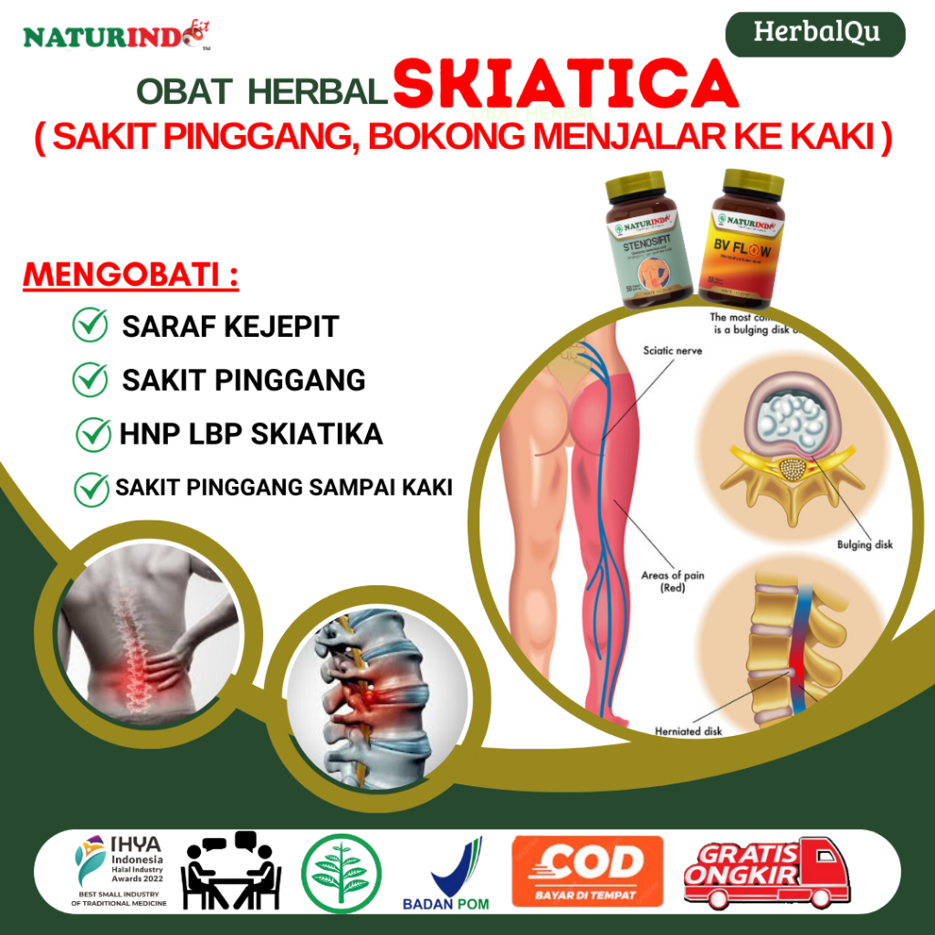 Jual Obat Saraf Kejepit Sakit Pinggang Sampai Kaki Dan Bokong Kaki Kesemutan Lumpuh Skiatika ...