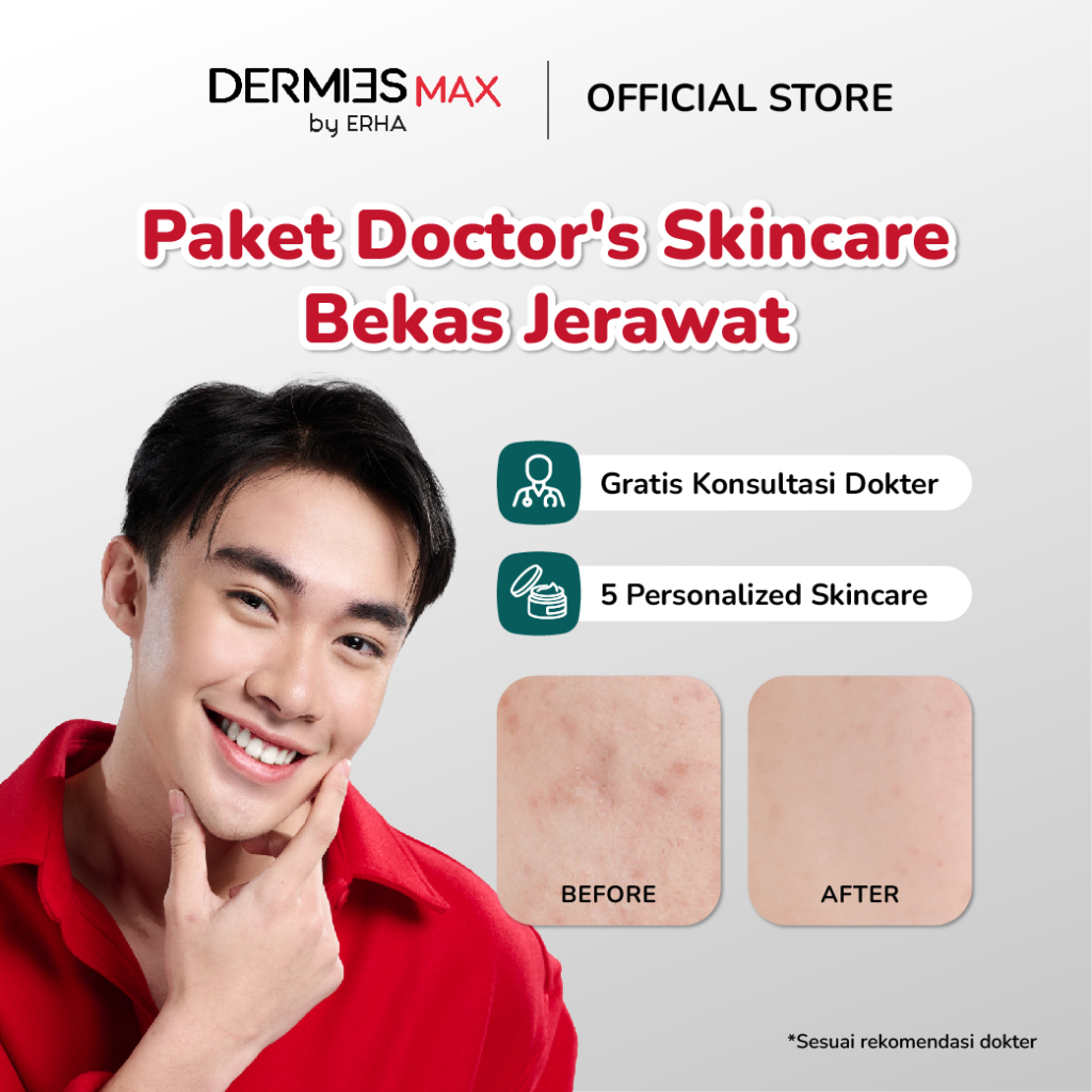 Jual Dermies Max Paket Doctor's Skincare untuk Bekas Jerawat | Shopee ...