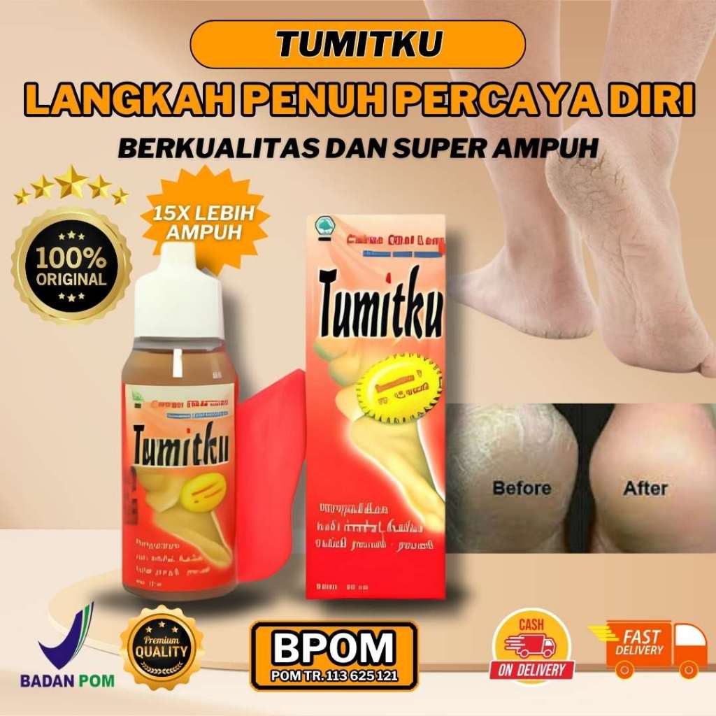 Jual Tumitku Obat Herbal Solusi Mengatasi Tumit Kaki Badak Kering Pecah ...