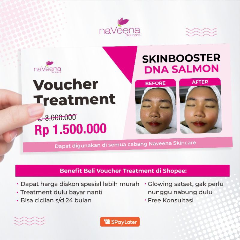 Jual Naveena Skin Booster DNA Salmon Voucher Treatment | Shopee Indonesia