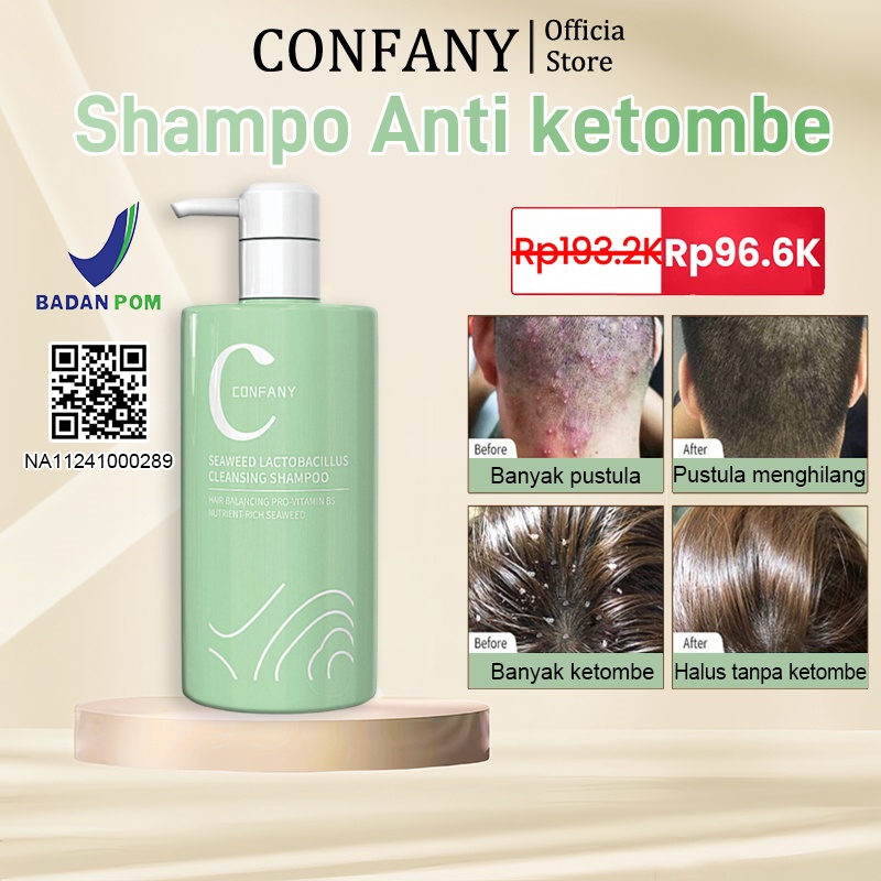 Jual CONFANY Shampo Anti Ketombe 500ml Sampo Anti Gatal And Ketombe Sea Salt Shampoo Penghilang ...