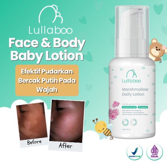 Jual Lullaboo Lotion Bayi Pelembab Kulit Bayi - Face & Body - Atasi ...