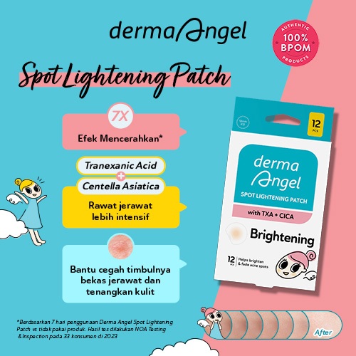 Jual Derma Angel Acne Spot Lightening Patch | Shopee Indonesia