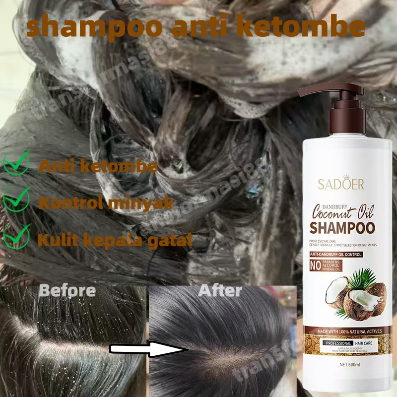 Jual (100% asli) Shampoo anti ketombe shampoo psoriasis penghilang ketombe anti gatal di kulit ...