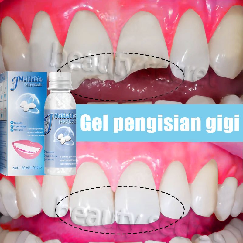Jual Tambalan gigi berlubang dan bahan pengisi untuk restorasi gigi palsu gigi palsu alami ...
