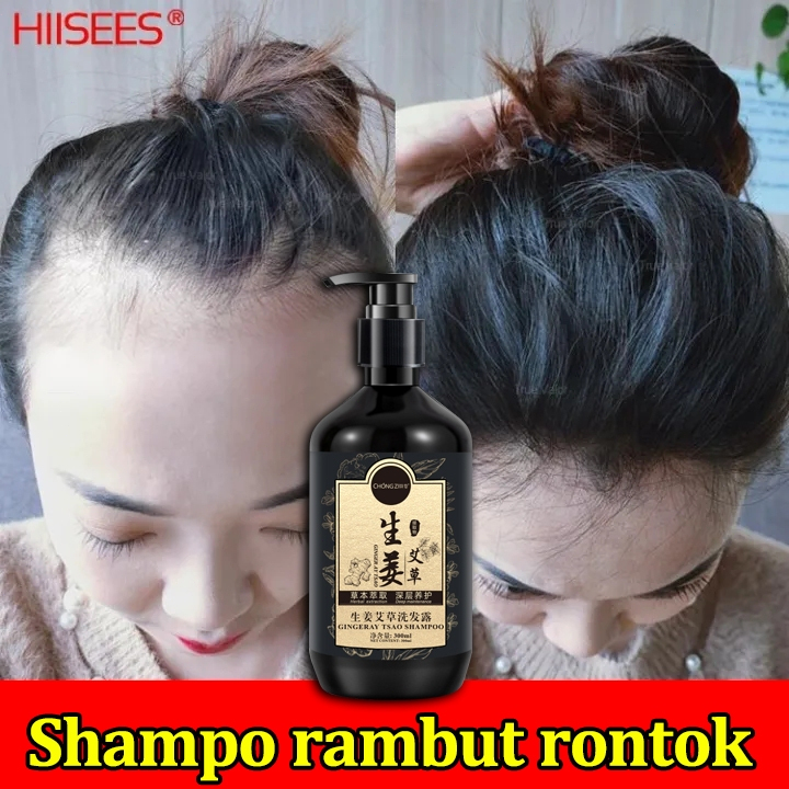 Jual Sampo Penumbuh Rambut Cepat Membantu Penumbuh Rambut Botak Shampoo ...