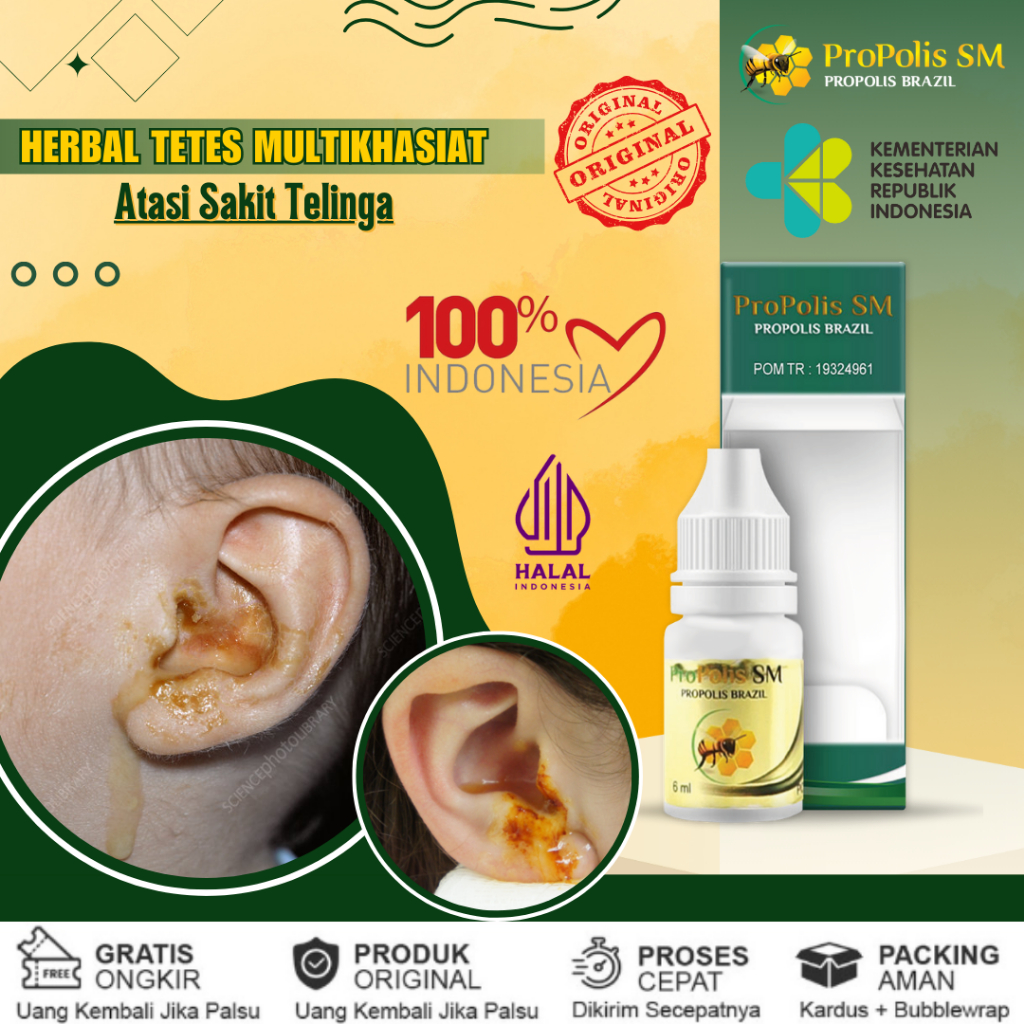 Jual Obat Tetes Telinga, Obat Sakit Telinga Berair, Obat Telinga Congek ...