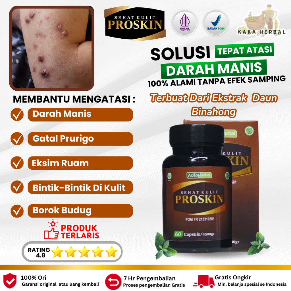 Jual Kaka Herbal - Obat Darah Manis, Obat Penyakit Prurigo, Obat Gatal ...
