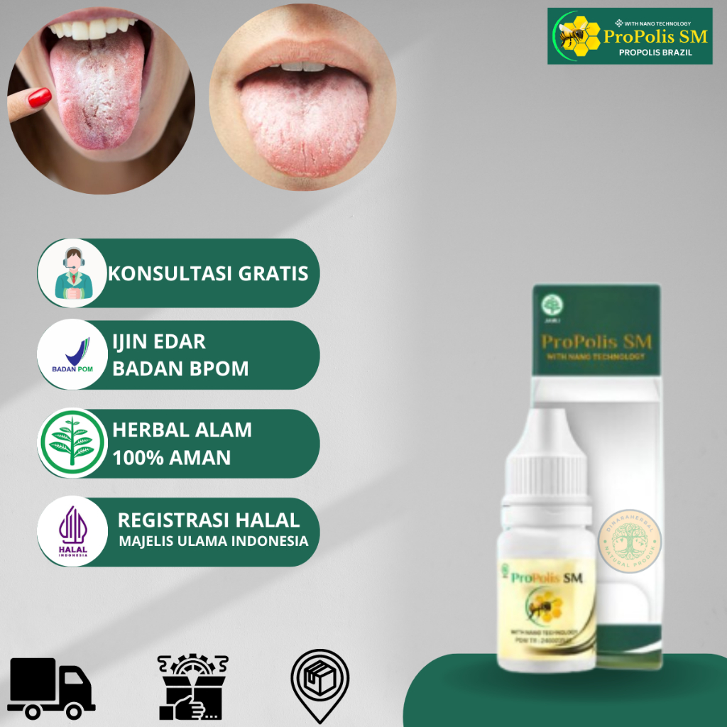Jual Obat Lidah Berjamur Anak & Dewasa, Pembersih Lidah Putih, Lidah ...