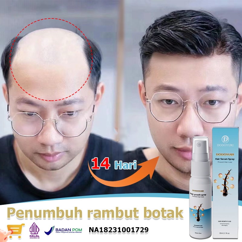 Jual DODOYURI Penumbuh rambut botak Serum penumbuh rambut Obat penumbuh ...