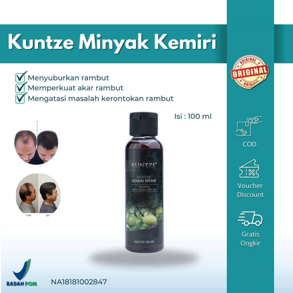 Jual Kuntze MINYAK KEMIRI HITAM ASLI PENUMBUH RAMBUT KEMIRI BLACK ...