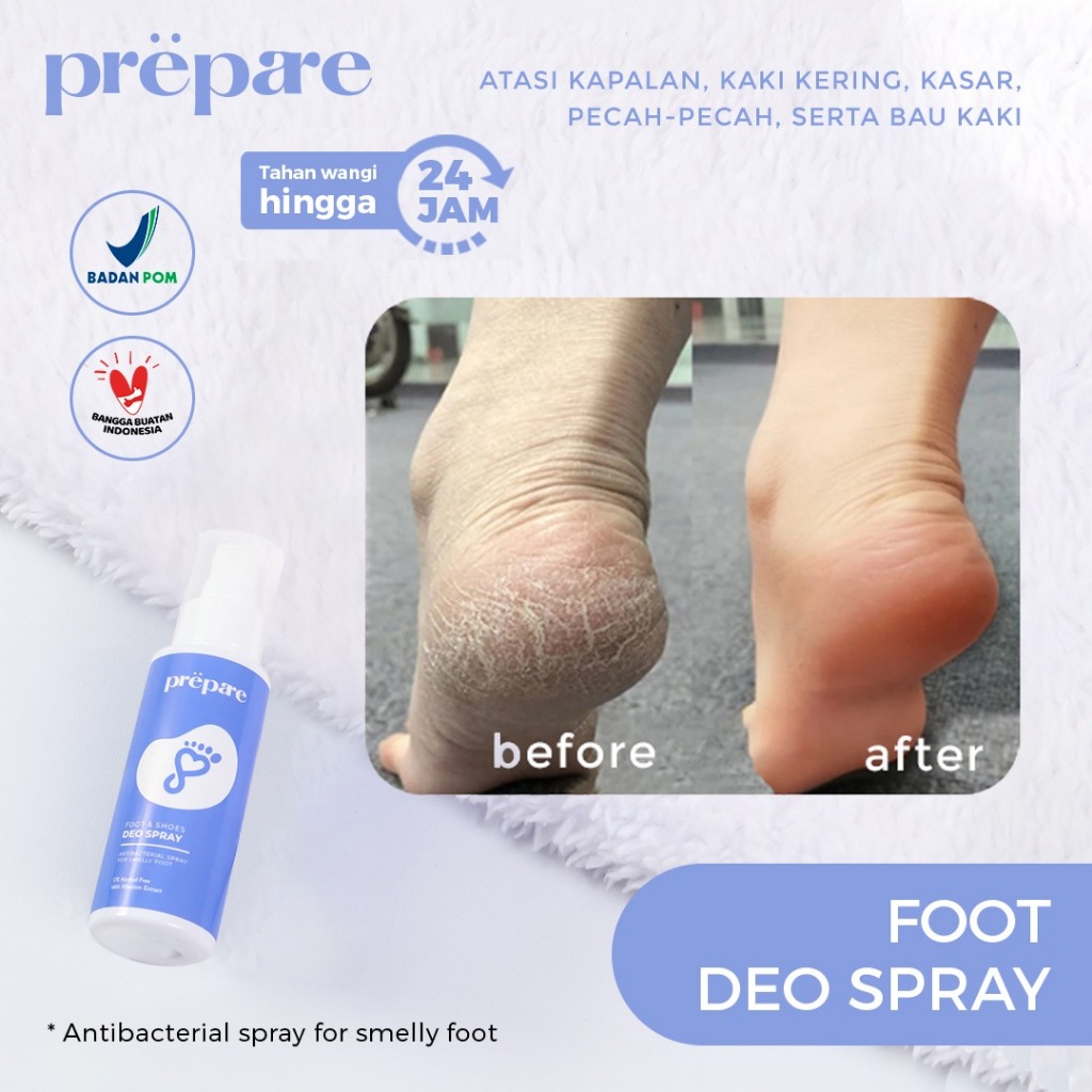 Jual PREPARE Penghilang Bau Kaki Obat Kapalan Penghalus Tumit Kaki Obat ...