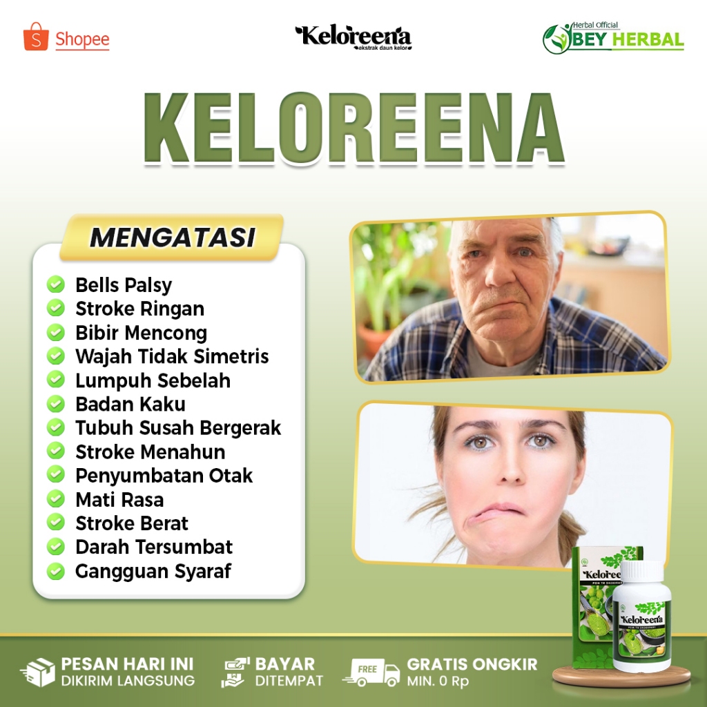 Jual Obat Bells Palsy / Stroke Ringan, Bibir Mencong, Wajah Tidak ...