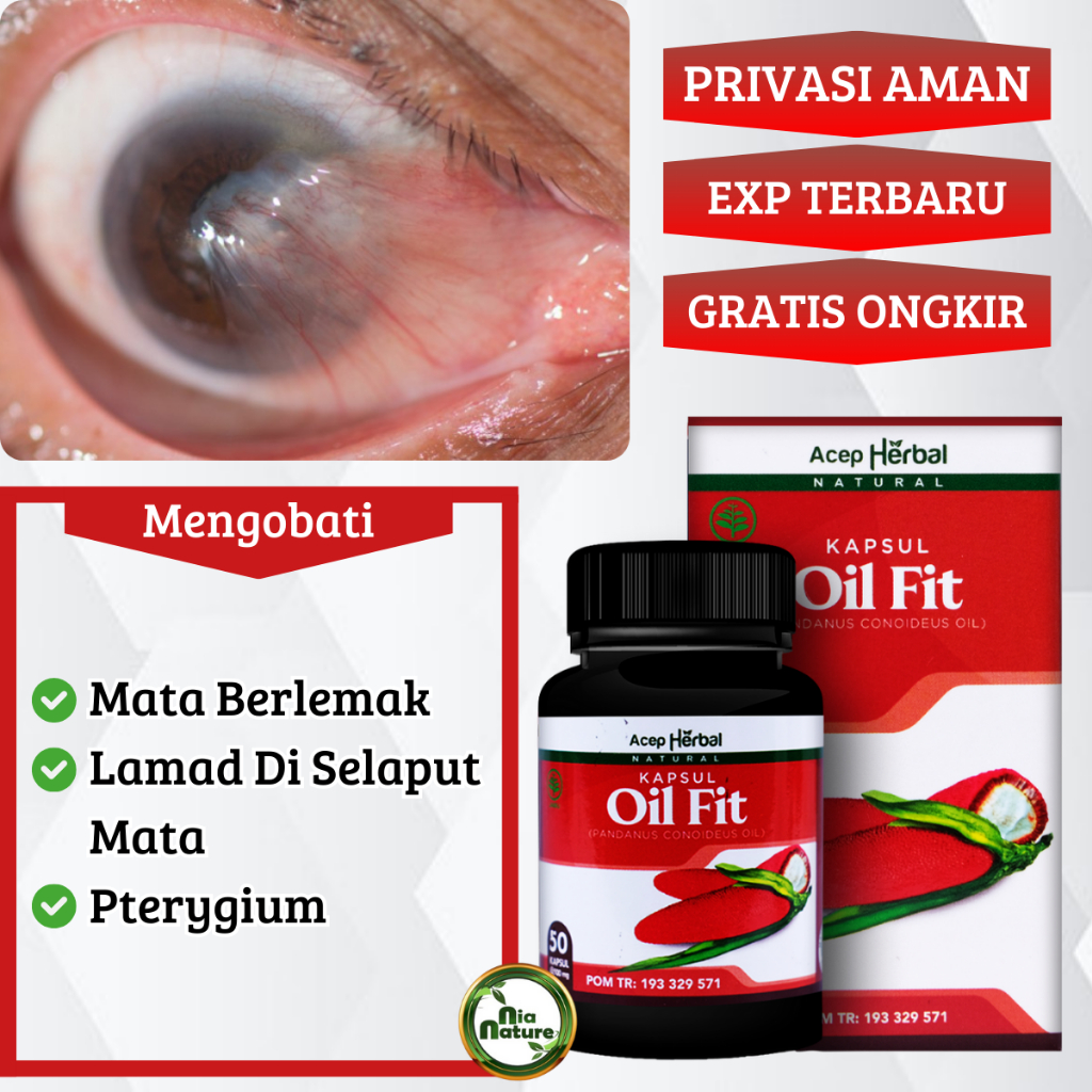 Jual Obat Mata Berlemak Lamad Di Selaput Mata Penghilang Pembersih ...