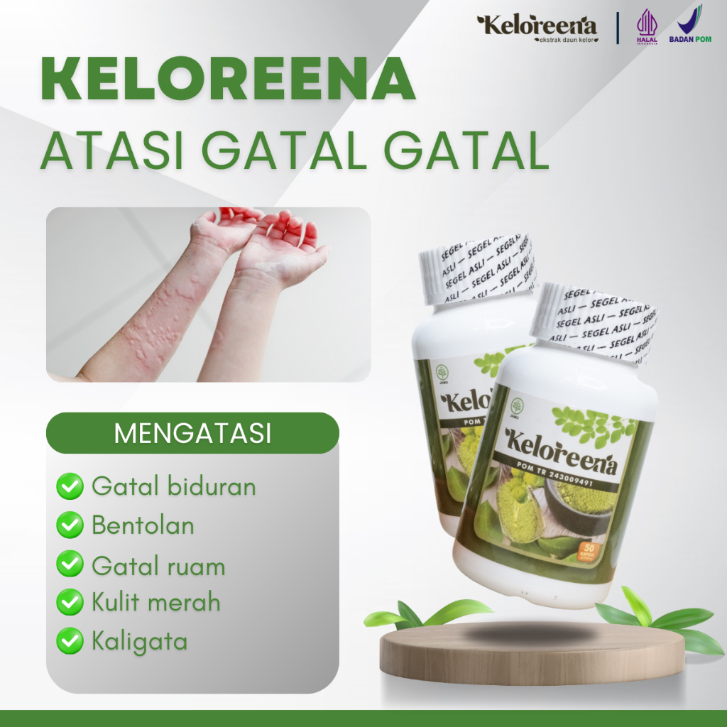 Jual Keloreena - Obat Bentol Dan Gatal, Biduran, Untuk Kaligata ...