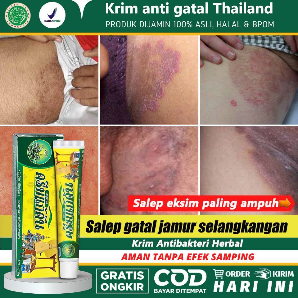 Jual Obat gatel Salep eksim paling ampuh Salep gatal jamur selangkangan 20g Thailand Salep ...