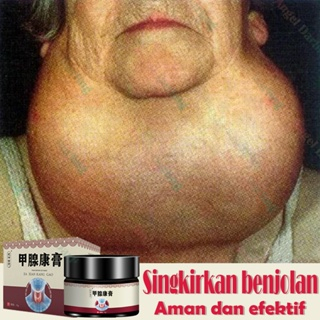 Jual Obat Herbal Tiroid Gondok Bengkak kelenjar leher Obat Gondok ...