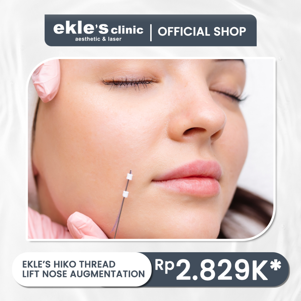 Jual EKLES HIKO Thread Lift Nose Augmentation Treatment | Shopee Indonesia