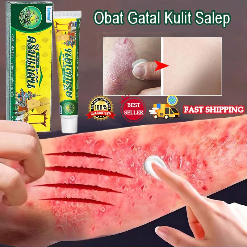 Jual Obat Gatal Kulit Salep 20g Eksim Jamur Dermatitis Alergi Kulit ...