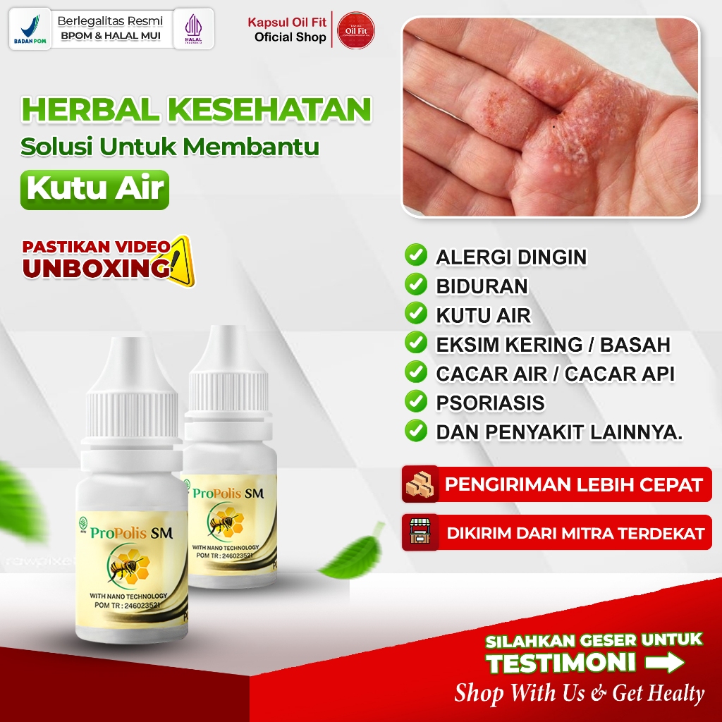 Jual Obat Kutu Air Untuk Kaki Bersisik Kaki Rayapan Tumit Kering Pecah ...