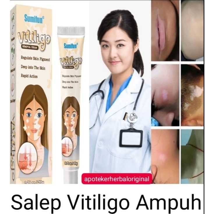 Jual 𝐎𝐑𝐈𝐆𝐈𝐍𝐀𝐋 Salep vitiligo, Salep Bercak Putih, Panu, Biang Keringat ...