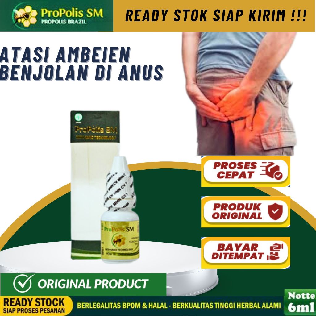 Jual Obat Wasir Ambeien/Ambeyen Benjolan Di Anus Nyeri Anus Lecet Fistula Ani Susah Bab Bab ...