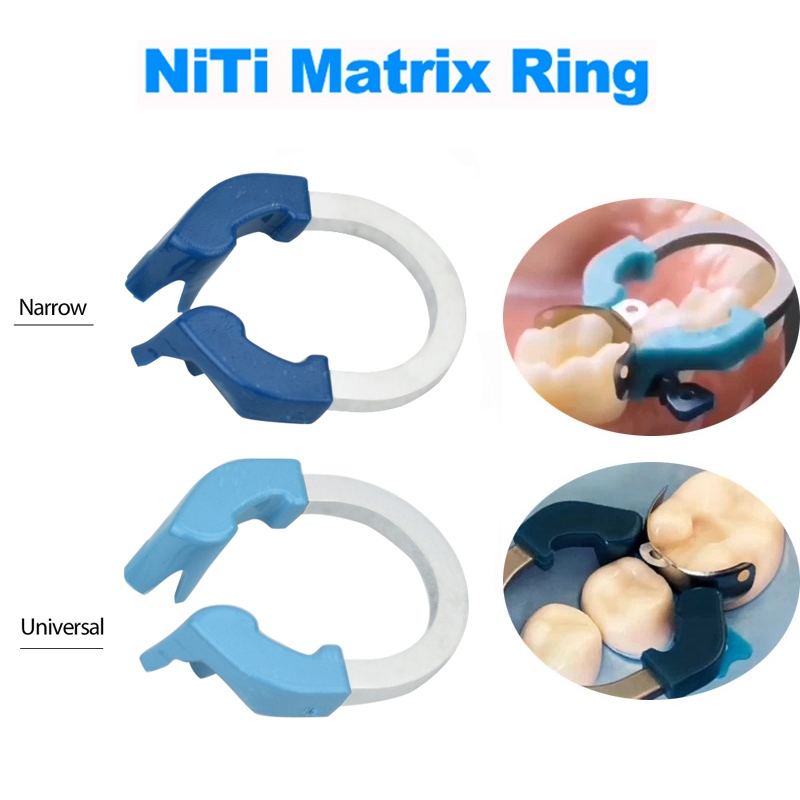 Jual Dental Matrix Bands NITI Metal Matrices Clamp Ring Sectional ...