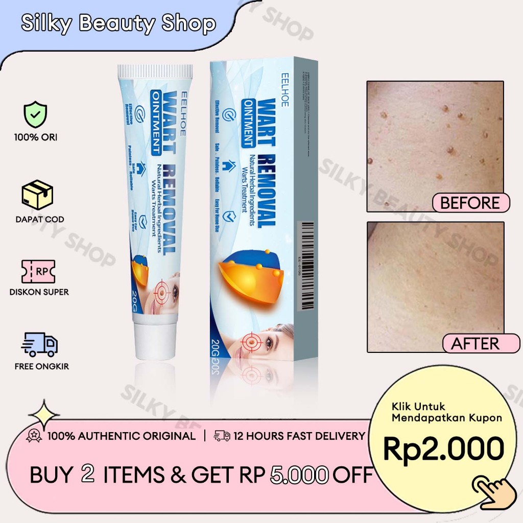Jual EELHOE【Beli 3 Gratis 2/COD/ORI】Wart Removal Cream 20g Salep ...