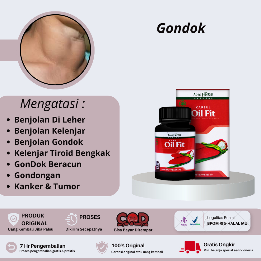 Jual Oil Fit - Obat Gondok Kelenjar Tiroid Hipertiroid Gondok Beracun ...
