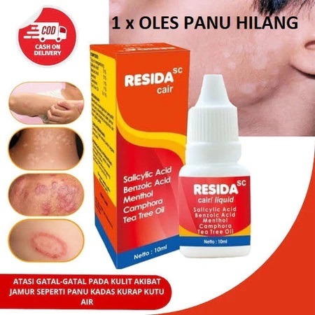 Jual Resida Cair Panu 10ml / Kalpanax Cair / Obat Gatal Gatal / Panu ...