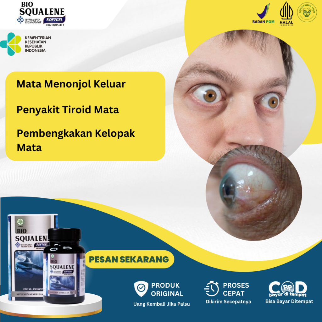 Jual Obat Mata Menonjol, Obat Mata Menonjol Keluar, Obat Bola Mata ...