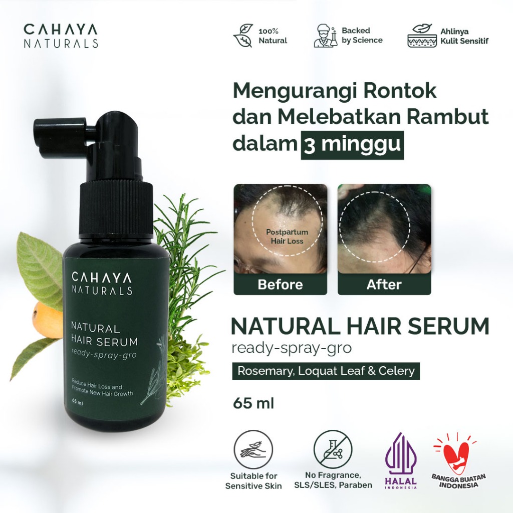 Jual Cahaya Naturals - Serum Penumbuh Rambut / Solusi Rambut Rontok ...
