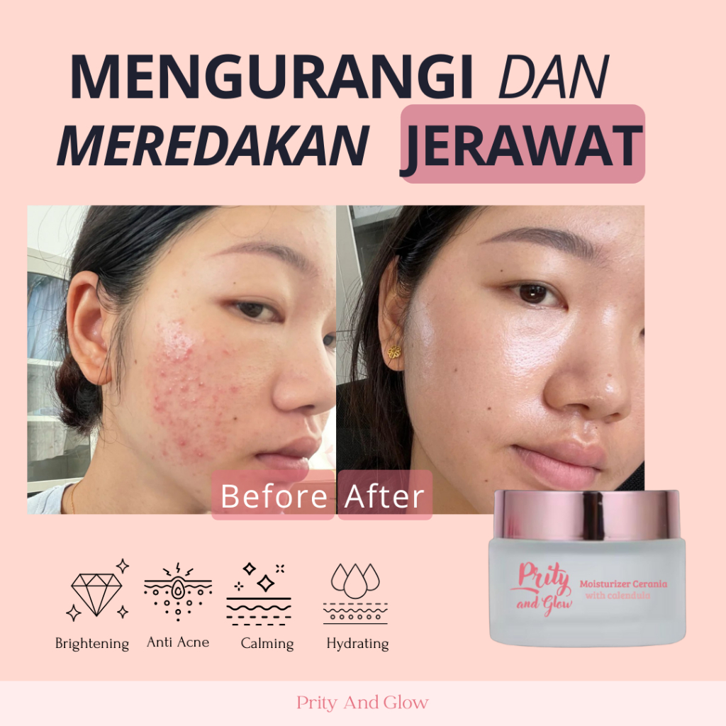 Jual PRITY AND GLOW - MOISTURIZER PELEMBAB JERAWAT ACNE MENCERAHKAN MEMPERBAIKI SKIN BARRIER ...