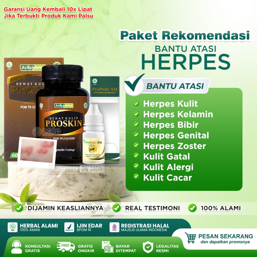 Jual Obat Herpes Kulit Seluruh Badan Salep Herpes Herpes Kelamin Herpes ...