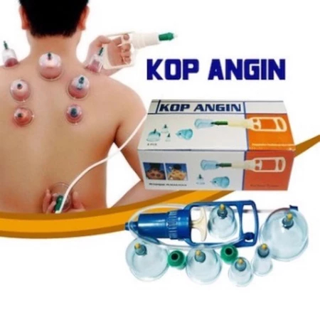 Jual Kop Angin Bekam - Alat Bekam Lengkap Kop Angin Kongsui Isi 6 Cup Untuk Menyembuhkan ...