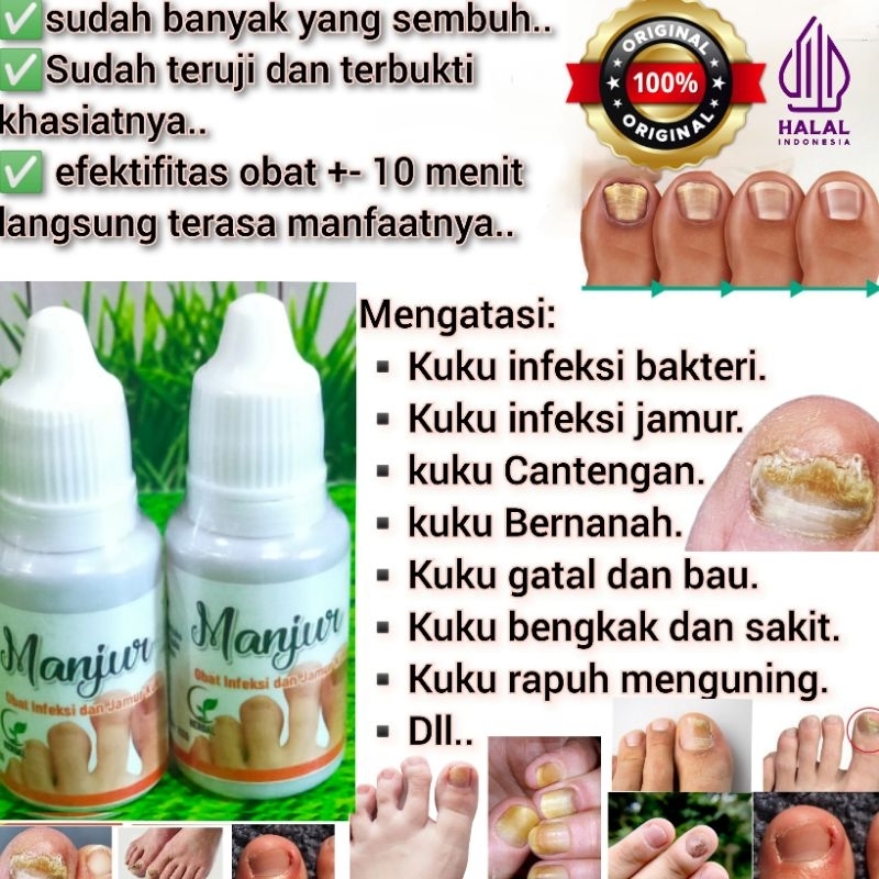 Jual obat kuku kuning cantengan infeksi jamur dan bakteri bau gatal ...