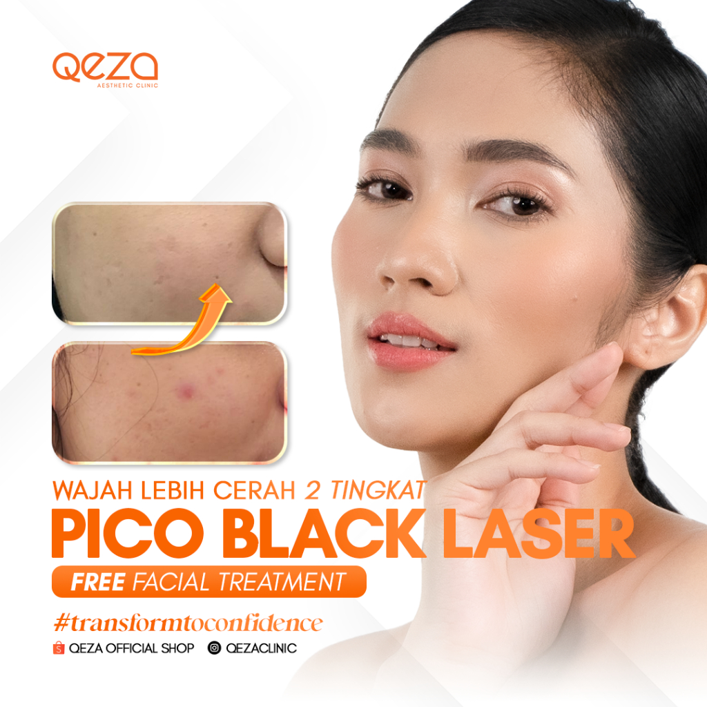 Jual QEZA BEST SELLER TREATMENT : PICO BLACK LASER SHOOT | Shopee Indonesia