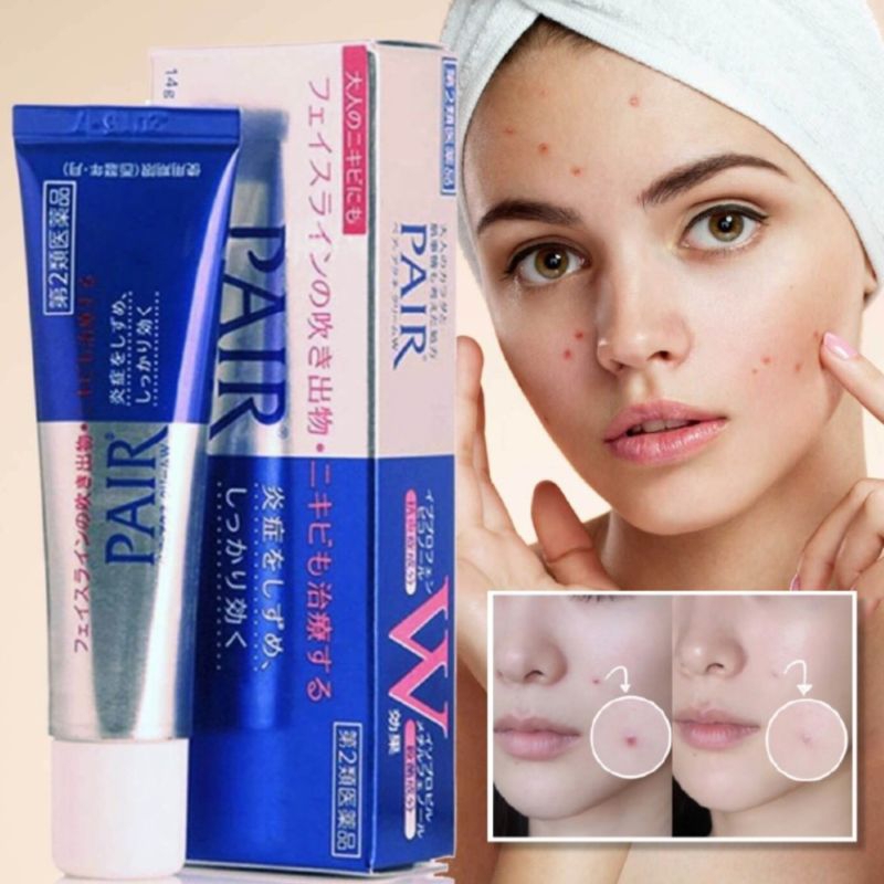 Jual READY STOCK!! LION PAIR ACNE CREAMY FOAM CLEAN LOTION OBAT JERAWAT ...